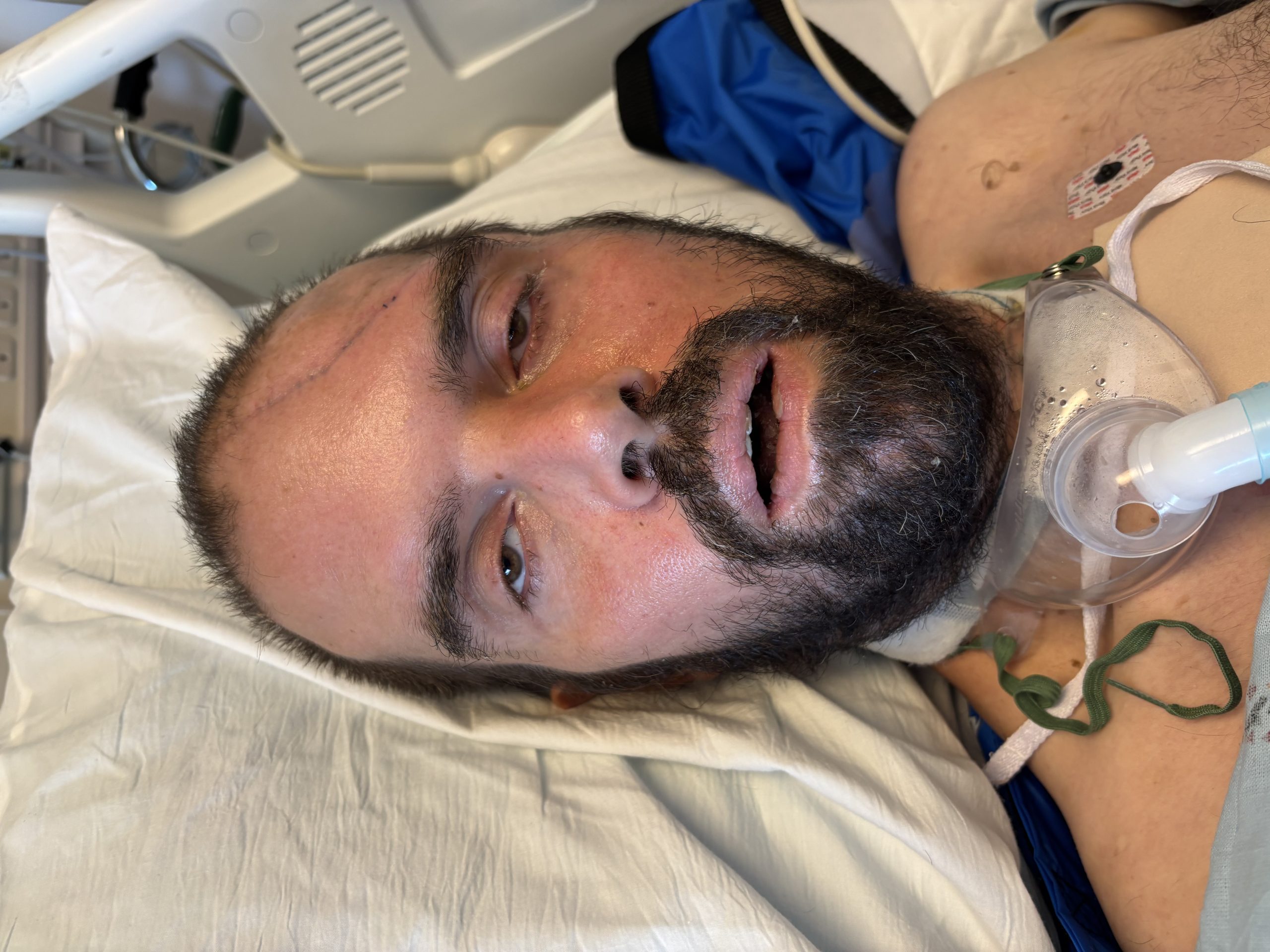 UCLA Medical Center Seeks Public’s Help Identifying Unconscious ‘John ...